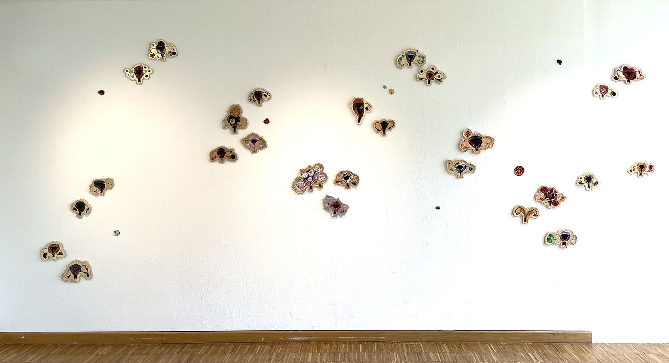 The Hysteria Project • Endo Revolution video