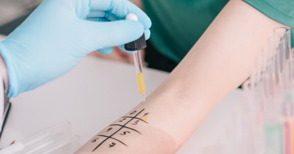 El prick test o pruebas cutáneas de la alergia Vídeo